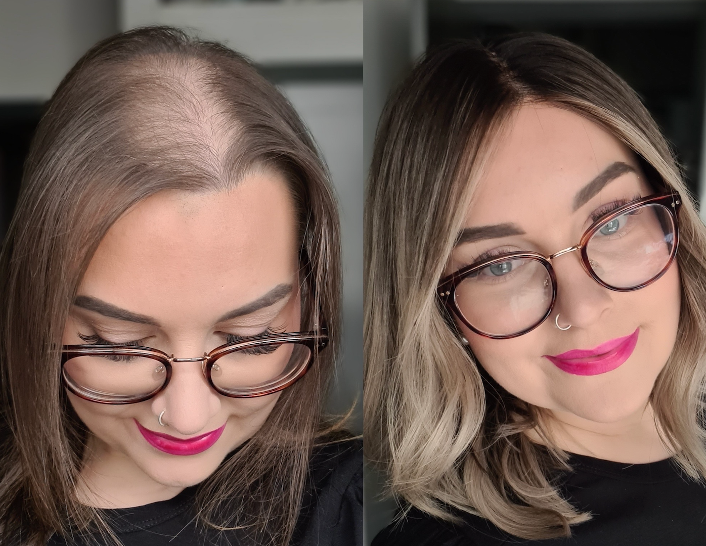7 Hair Loss Influencers You Need to Be Following | Clingy Fibers