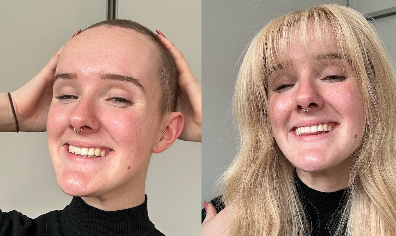Understanding Stress and Its Connection to Hair Loss | Clingy Fibers