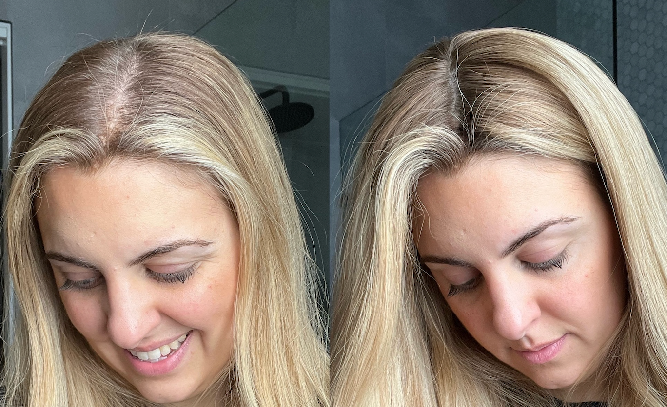Embracing the Journey: Finding Solace in the Facts about Female Hair L ...