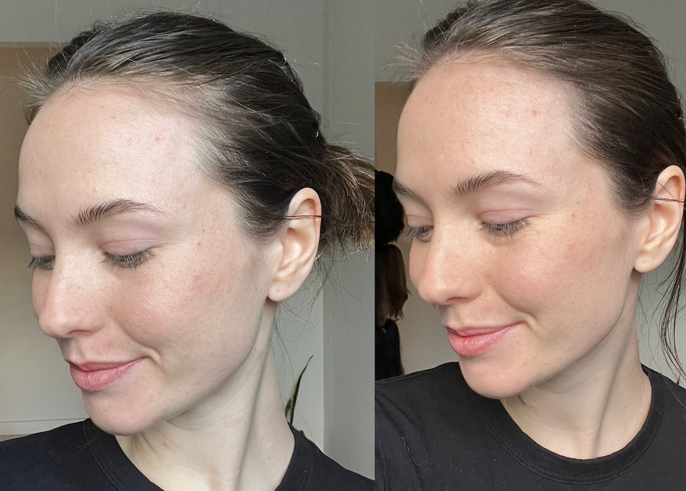 Did you know external factors can cause hair loss? | Clingy Fibers
