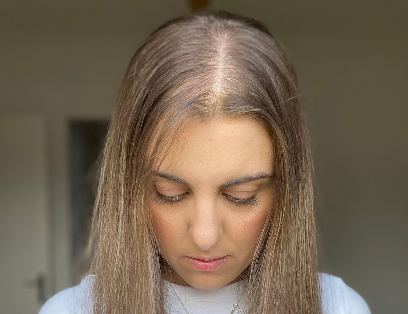 Hair Loss in My 20's | Clingy Fibers