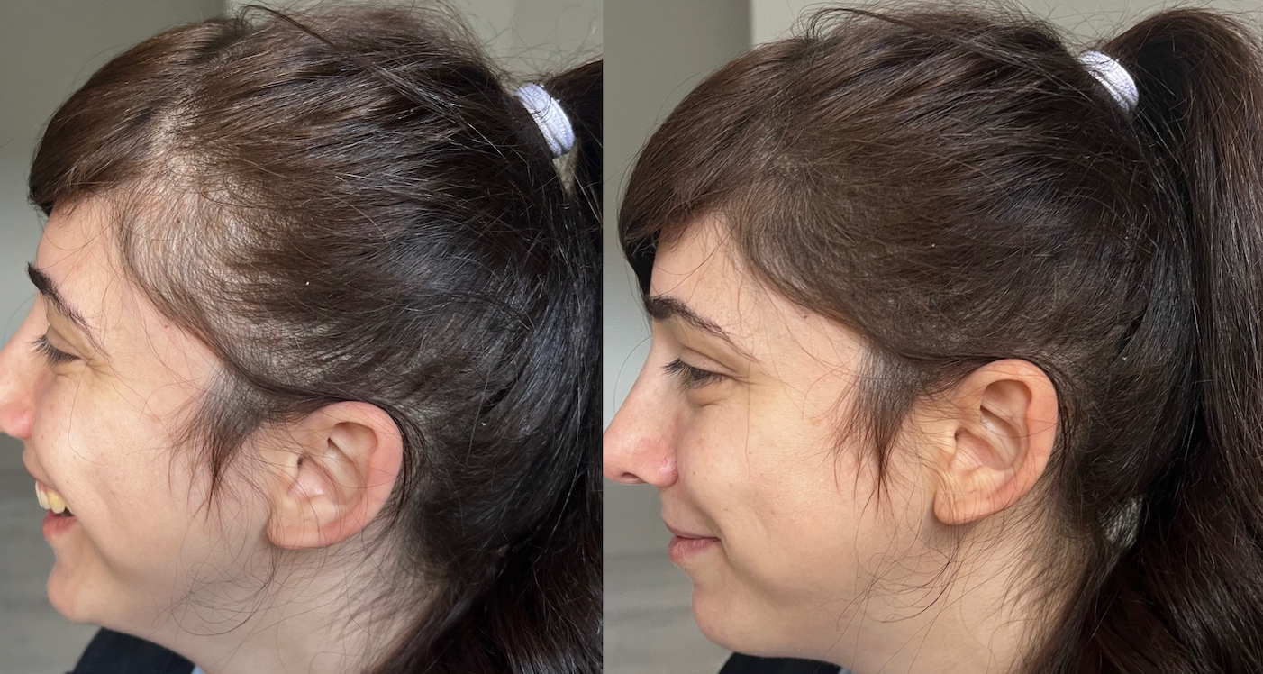 Everything There is to Know About Clingy Hair Fibers | Clingy Fibers